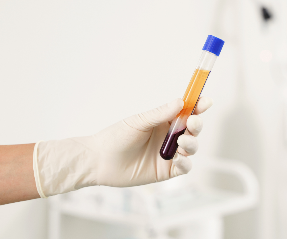 The Gael Center: Unlocking the Potential of Platelet Rich Plasma (PRP ...